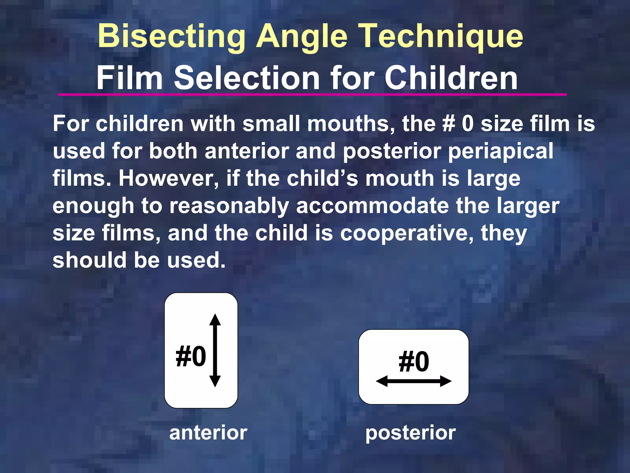 radio-graphic-techniques-bisecting-and-occlusal | PDF