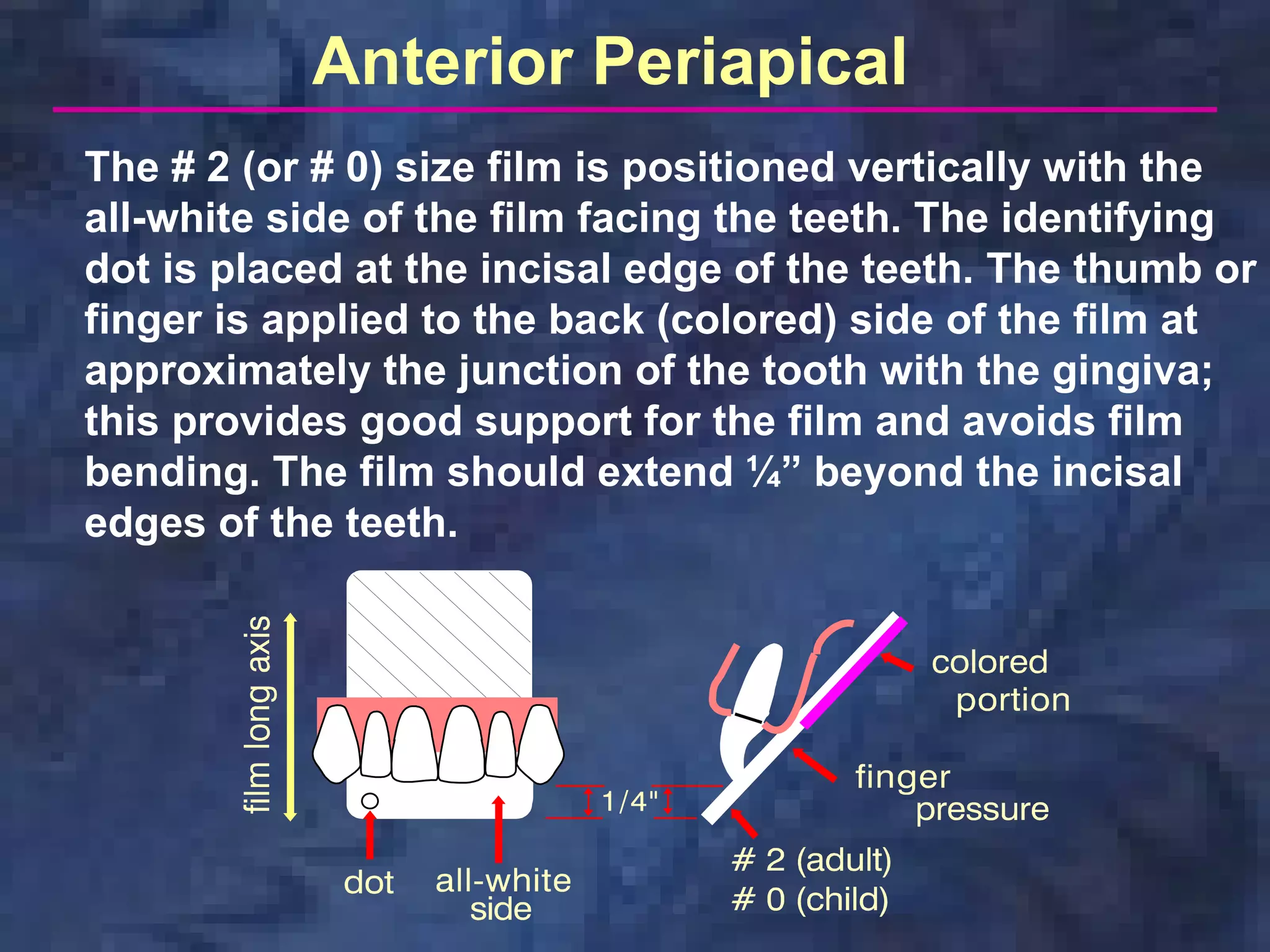 radio-graphic-techniques-bisecting-and-occlusal | PDF