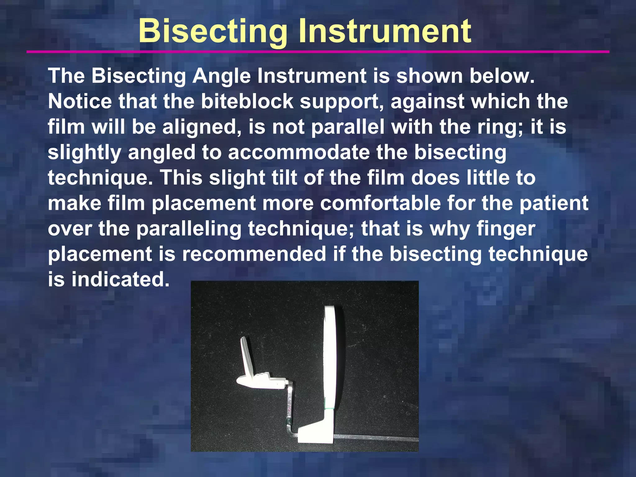 radio-graphic-techniques-bisecting-and-occlusal | PDF