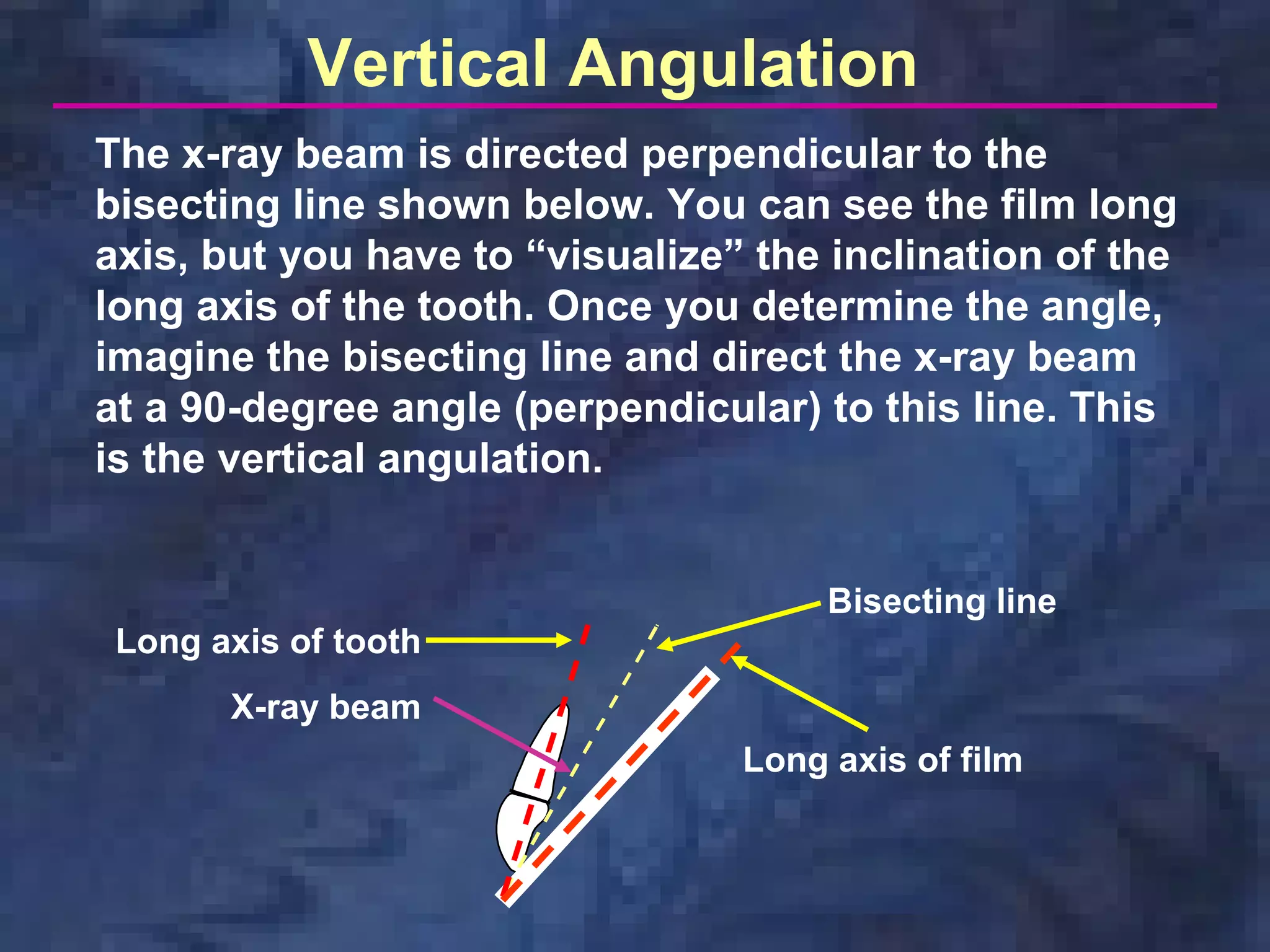 radio-graphic-techniques-bisecting-and-occlusal | PDF