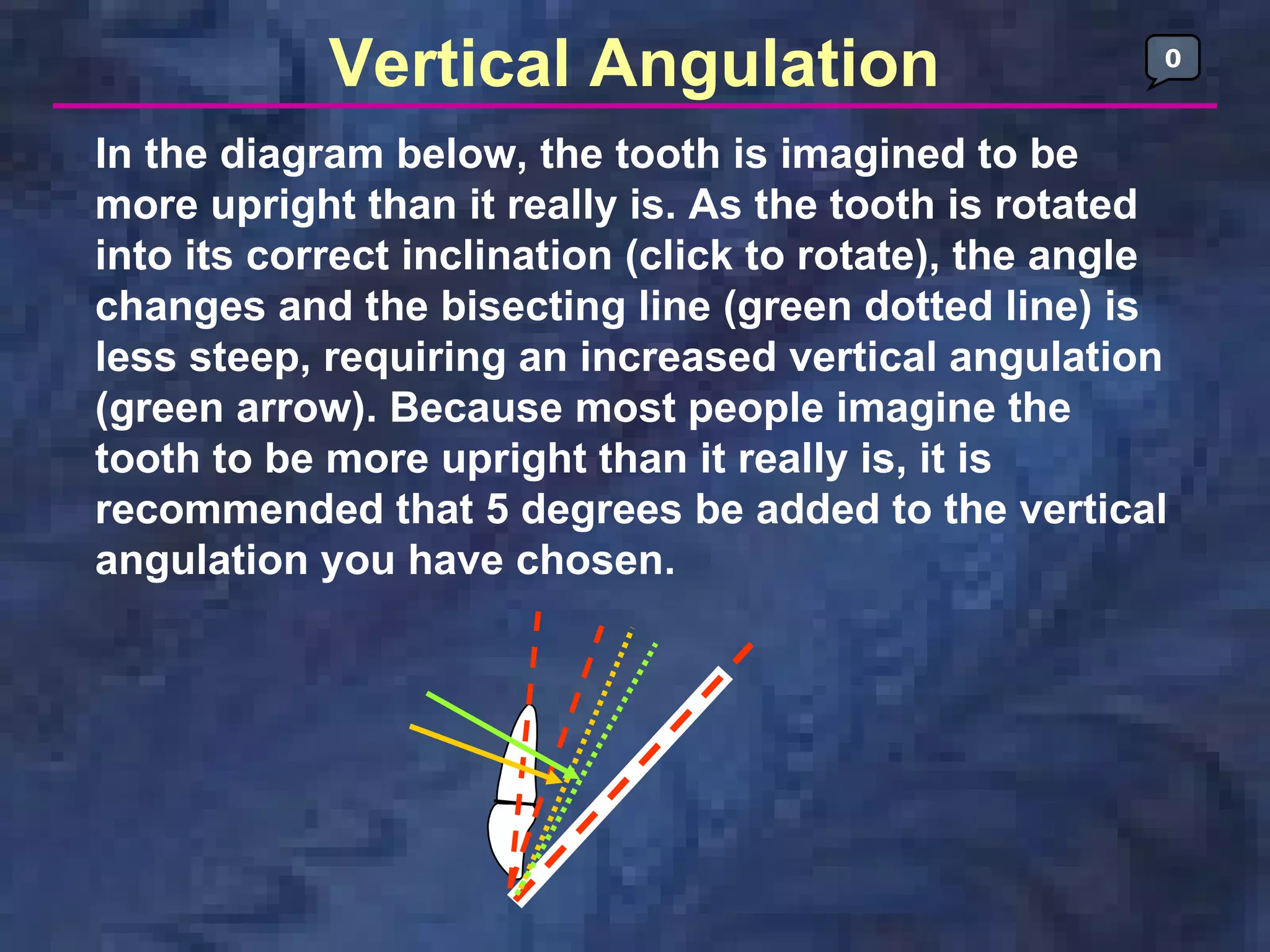radio-graphic-techniques-bisecting-and-occlusal | PDF