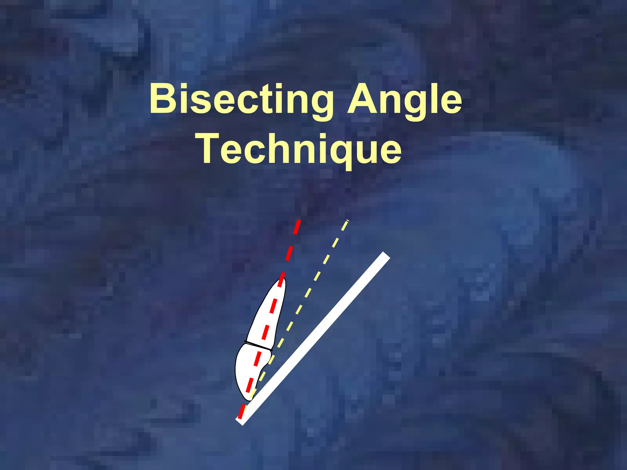 radio-graphic-techniques-bisecting-and-occlusal | PDF
