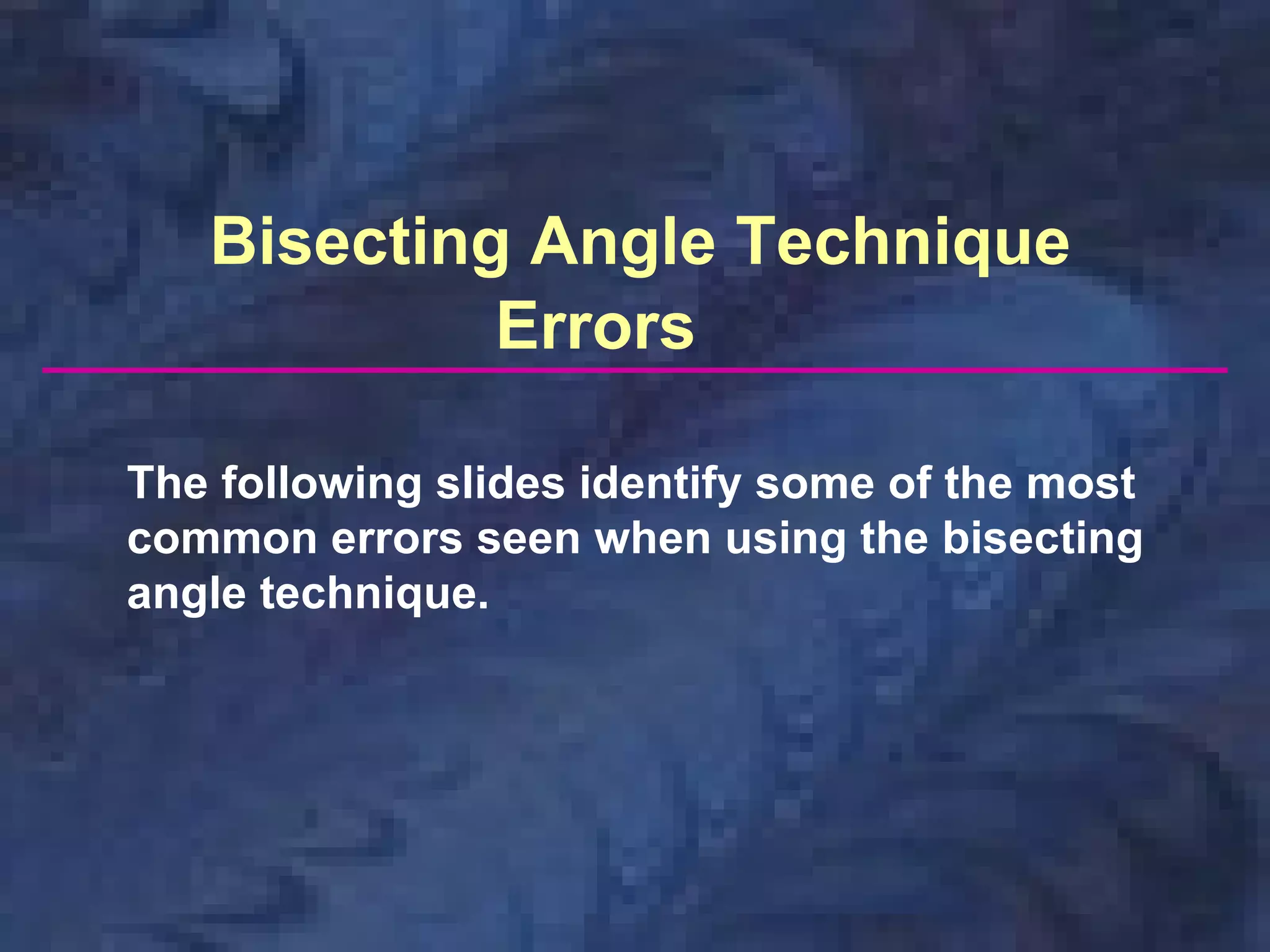 radio-graphic-techniques-bisecting-and-occlusal | PDF | Operating ...