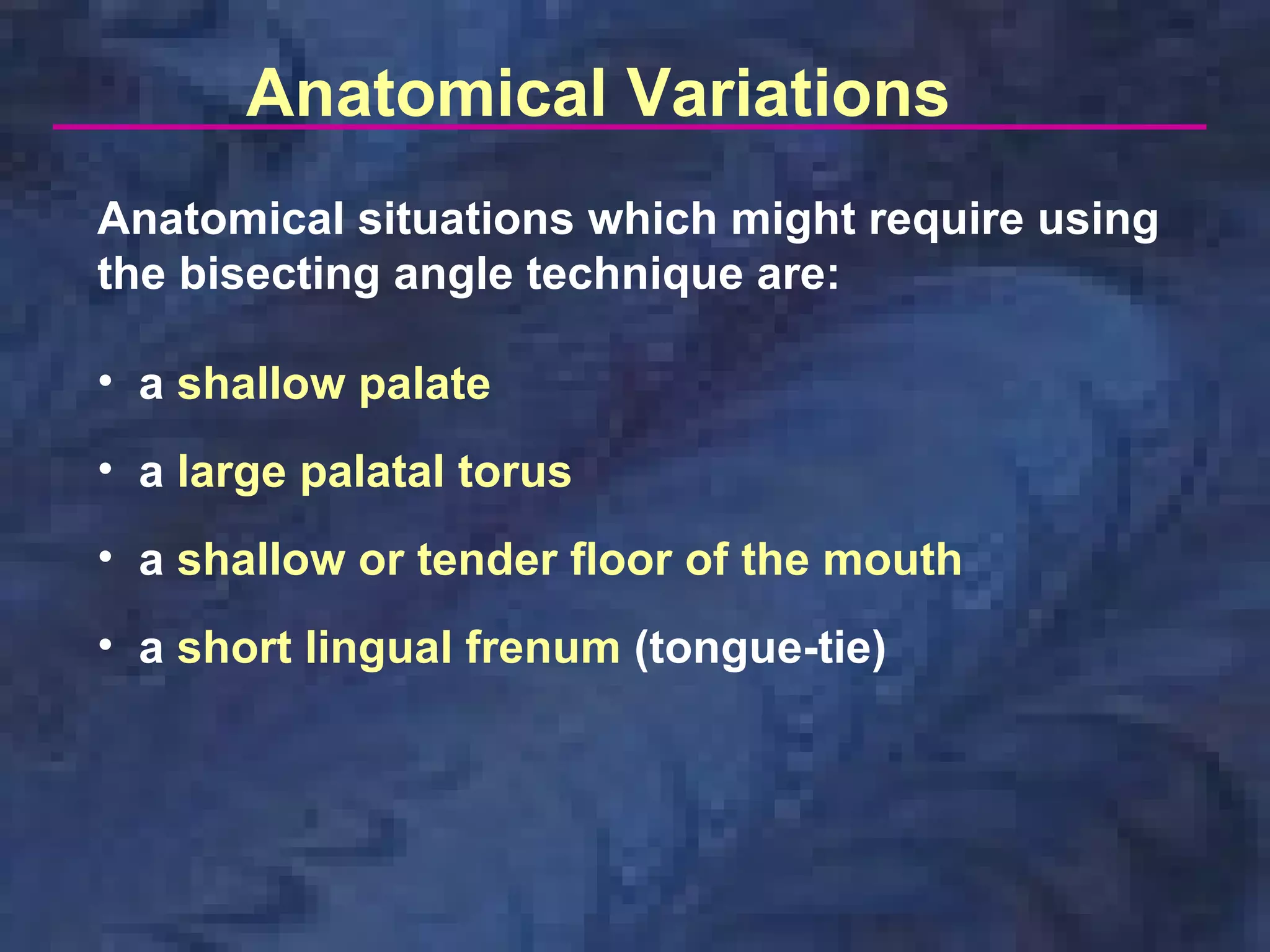 radio-graphic-techniques-bisecting-and-occlusal | PDF