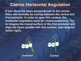 radio-graphic-techniques-bisecting-and-occlusal | PDF