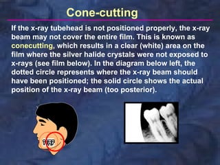 radio-graphic-techniques-bisecting-and-occlusal | PDF