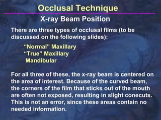 radio-graphic-techniques-bisecting-and-occlusal | PDF