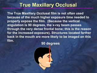 radio-graphic-techniques-bisecting-and-occlusal | PDF