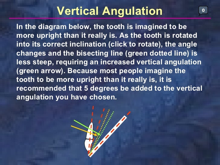 radio-graphic-techniques-bisecting-and-occlusal