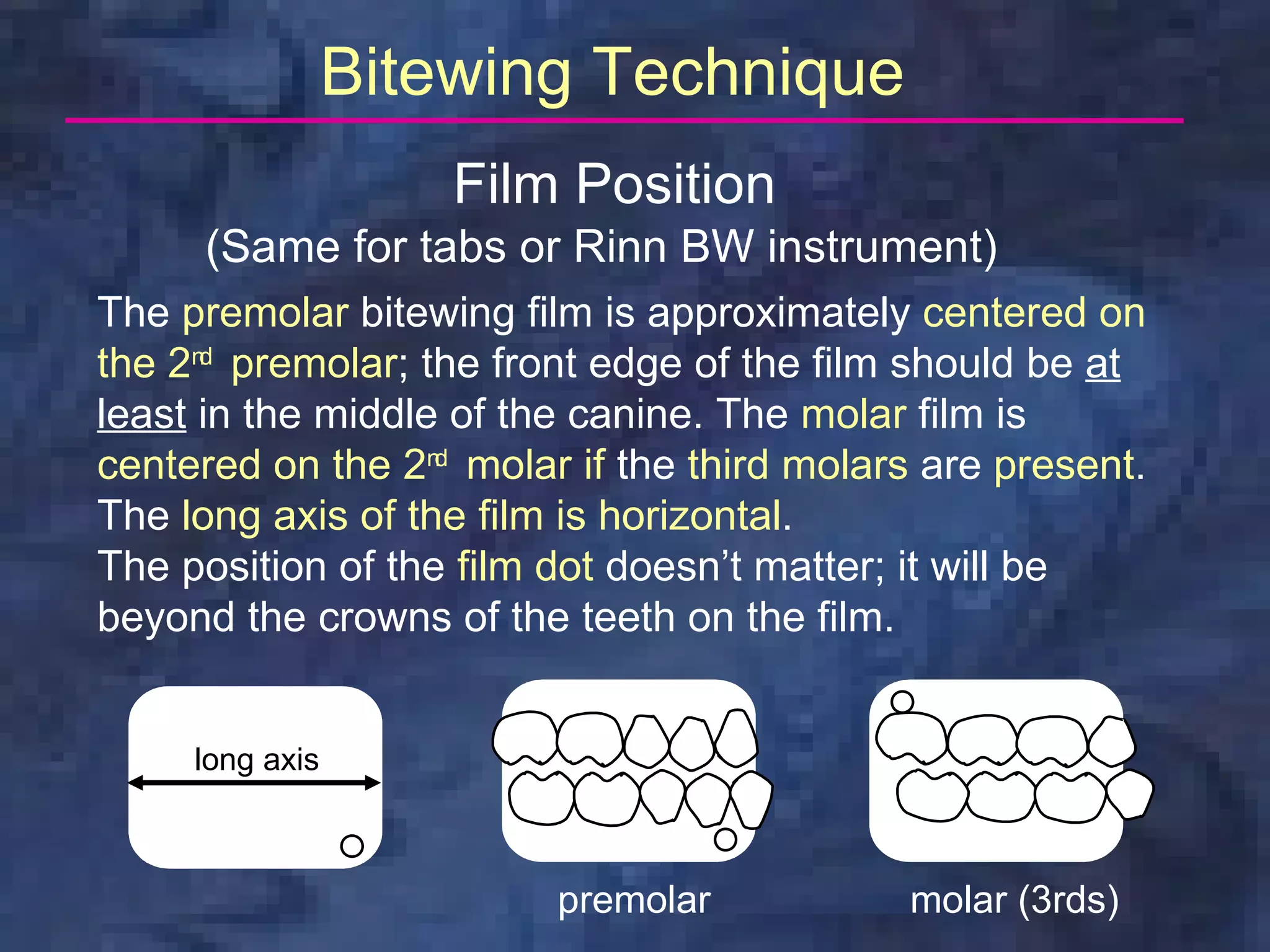 radiology-bitewing-technique | PDF