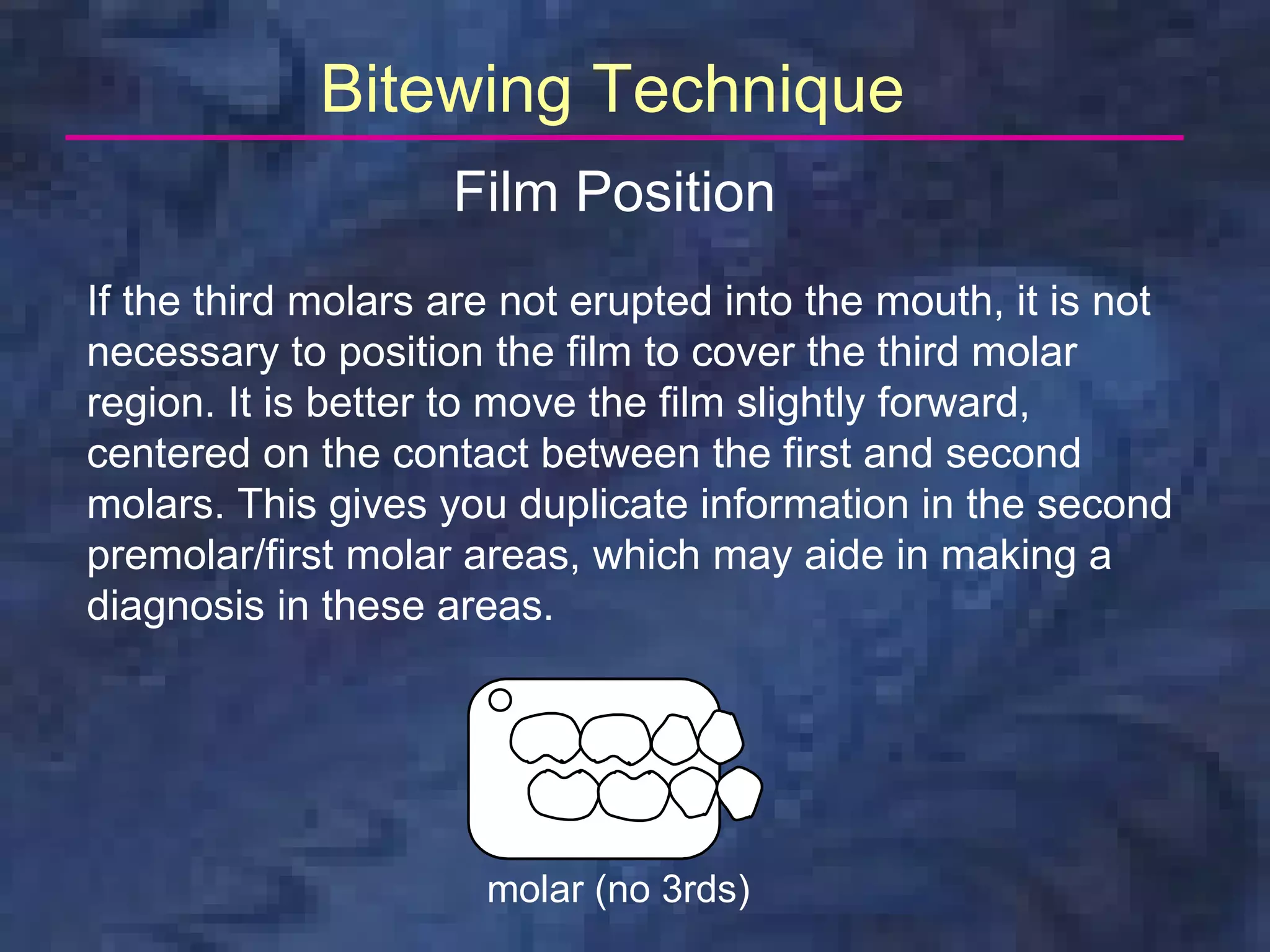 radiology-bitewing-technique | PDF