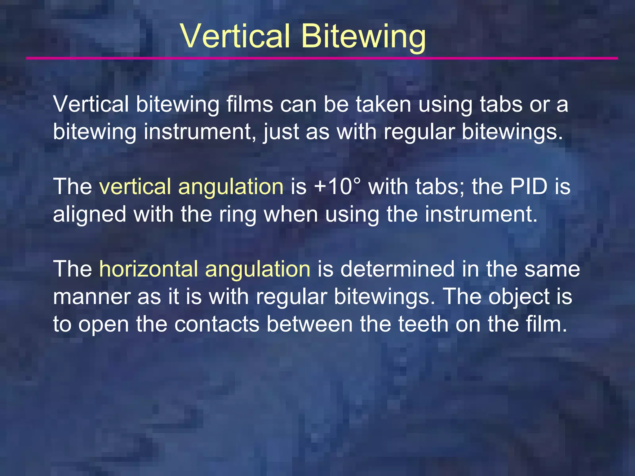 radiology-bitewing-technique | PDF