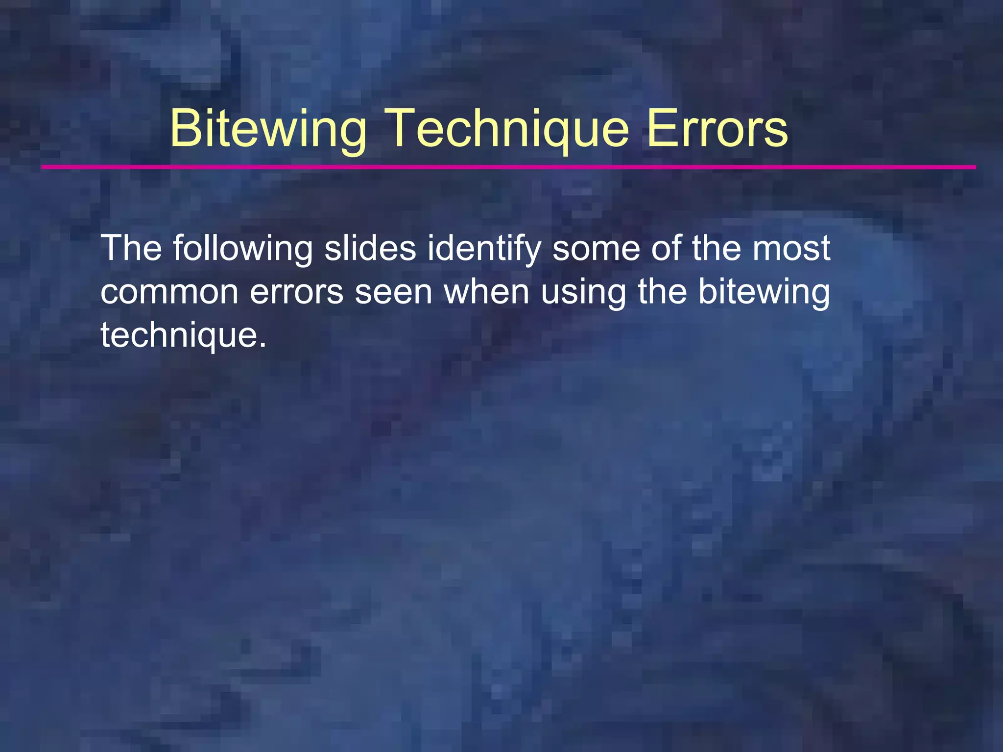 radiology-bitewing-technique | PDF