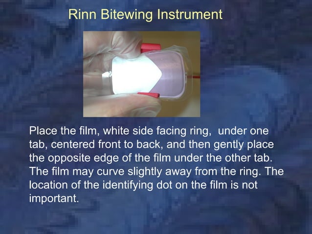 radiology-bitewing-technique | PDF | Dental Health | Diseases and ...