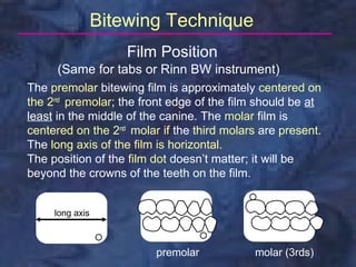 radiology-bitewing-technique | PDF | Dental Health | Diseases and ...