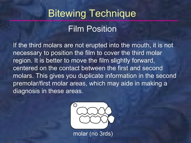 radiology-bitewing-technique | PDF | Dental Health | Diseases and ...