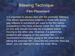 radiology-bitewing-technique | PDF