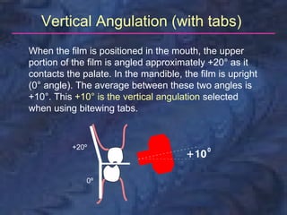radiology-bitewing-technique | PDF