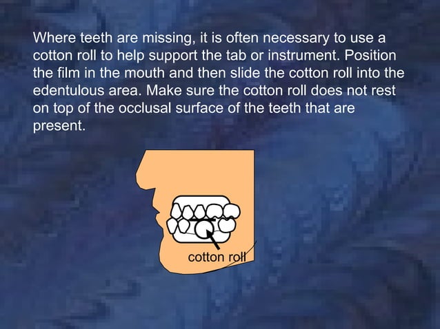 radiology-bitewing-technique | PDF | Dental Health | Diseases and ...