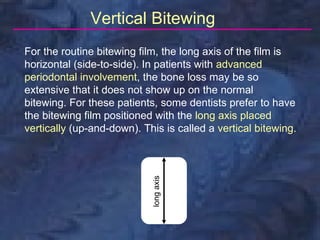 radiology-bitewing-technique | PDF