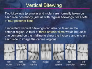 radiology-bitewing-technique | PDF