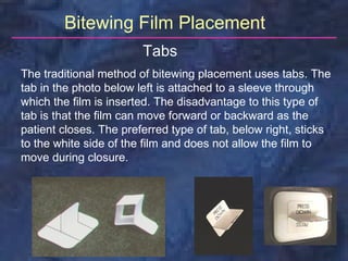 radiology-bitewing-technique | PDF