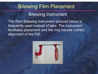 radiology-bitewing-technique | PDF
