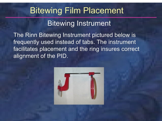 radiology-bitewing-technique | PDF | Dental Health | Diseases and ...