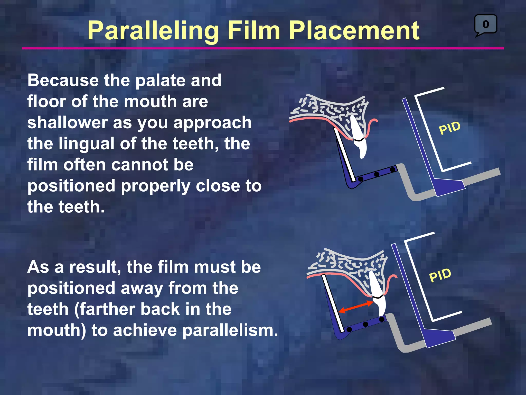 radiology-paralleling-technique | PDF