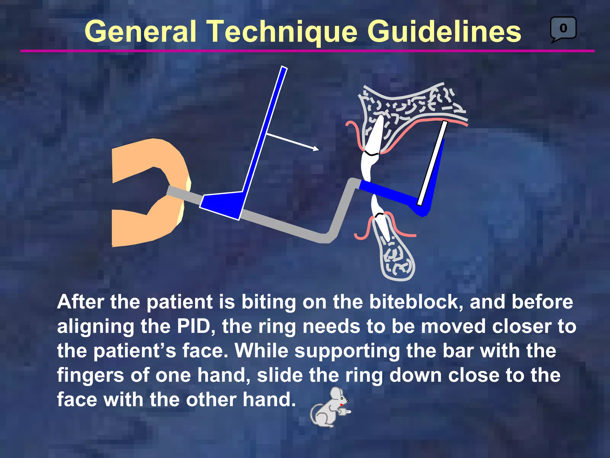 radiology-paralleling-technique | PDF