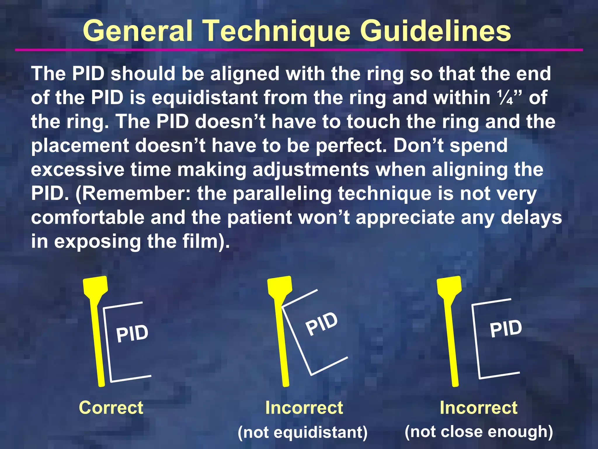 radiology-paralleling-technique | PDF
