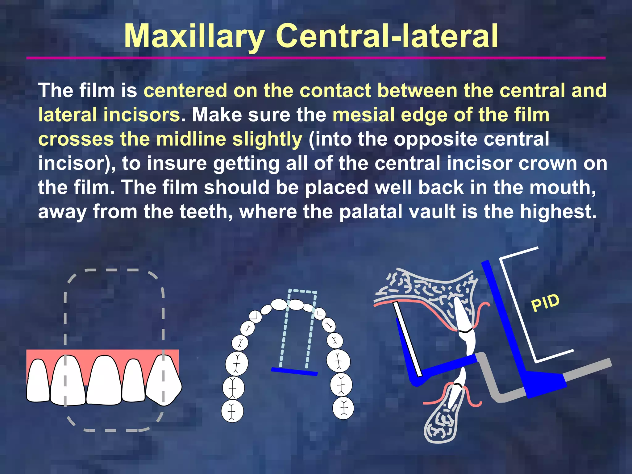 radiology-paralleling-technique | PDF