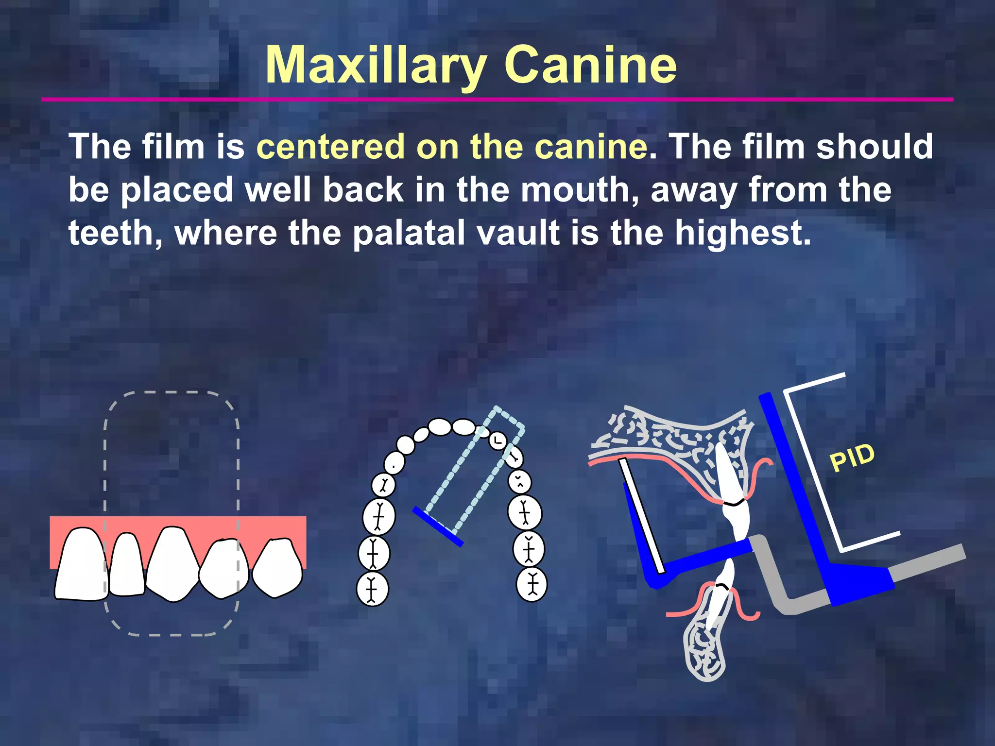radiology-paralleling-technique | PDF