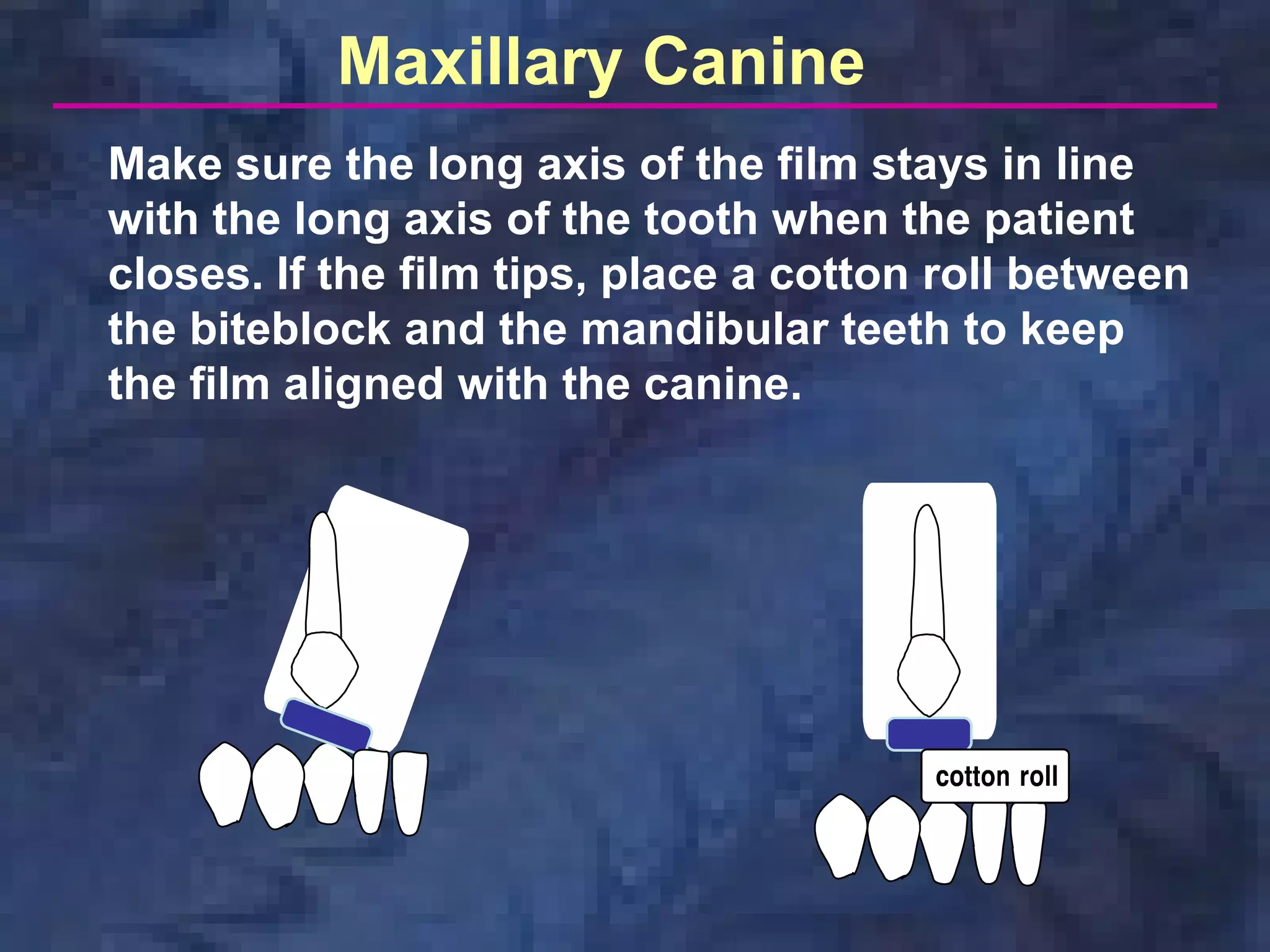 radiology-paralleling-technique | PDF