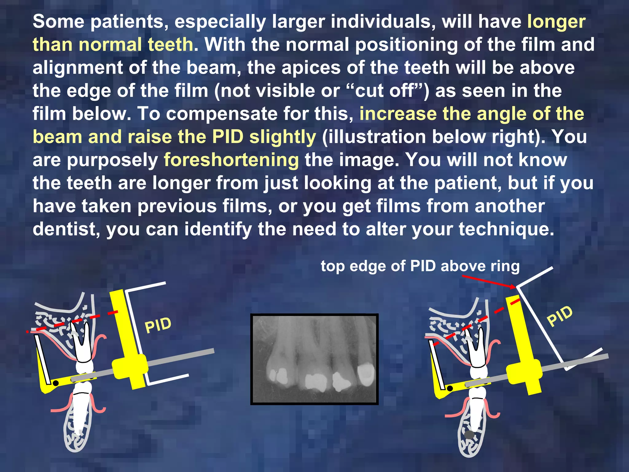 radiology-paralleling-technique | PDF