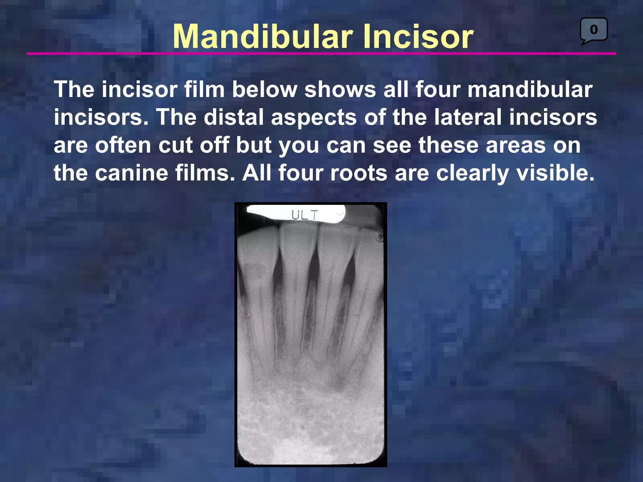 radiology-paralleling-technique | PDF