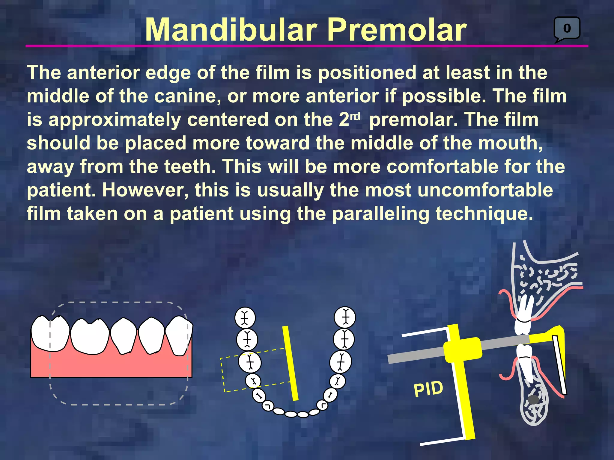 radiology-paralleling-technique | PDF