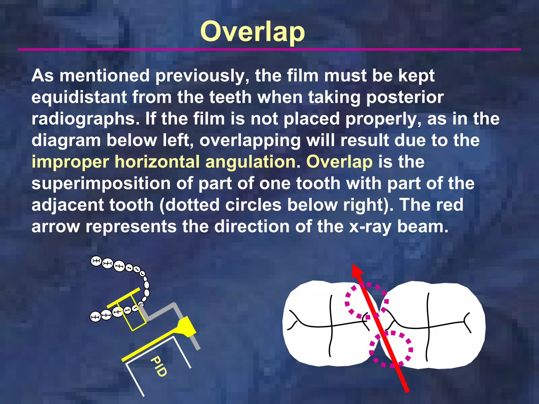 radiology-paralleling-technique | PDF