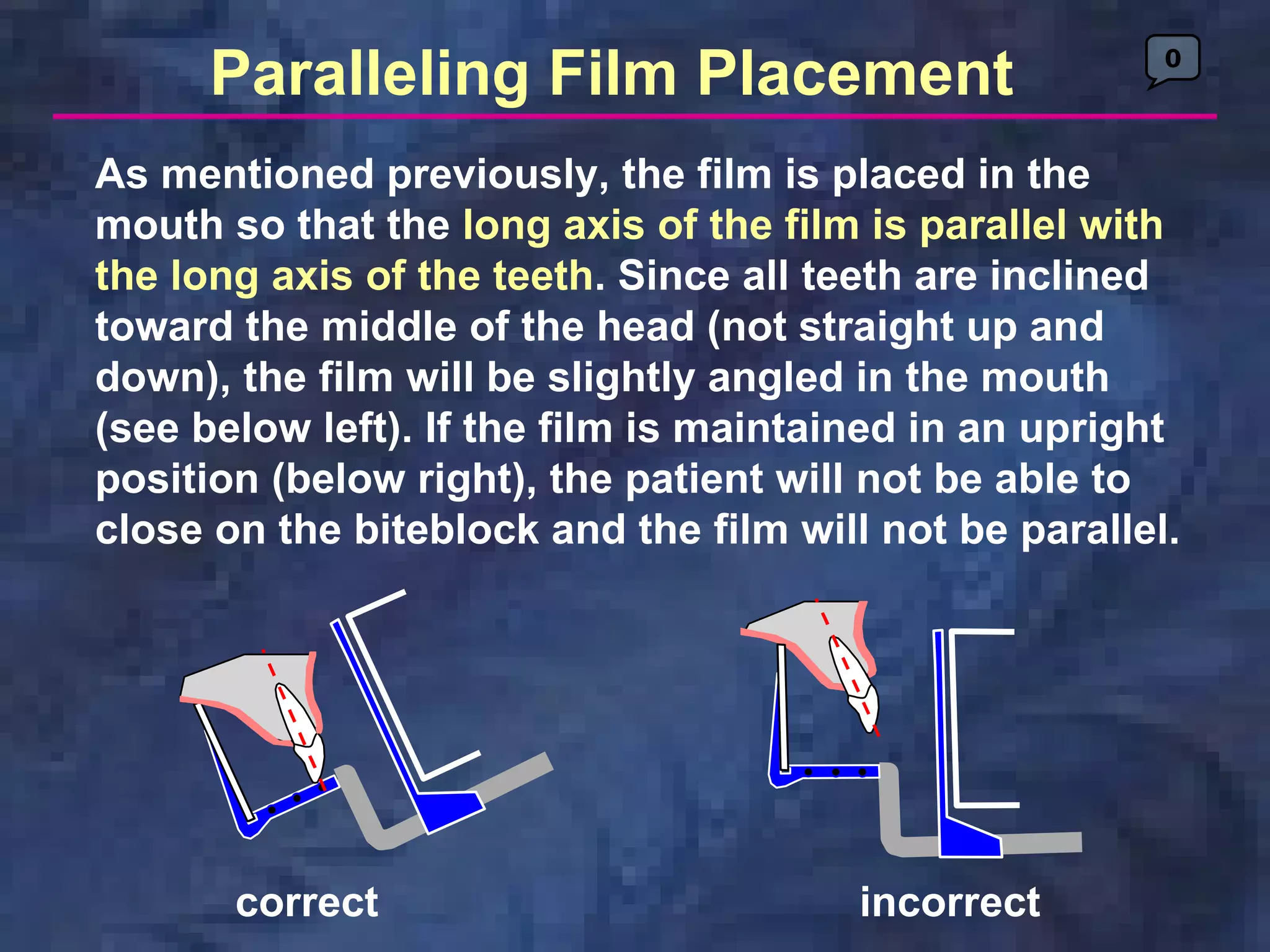 radiology-paralleling-technique | PDF