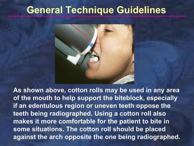 radiology-paralleling-technique | PDF