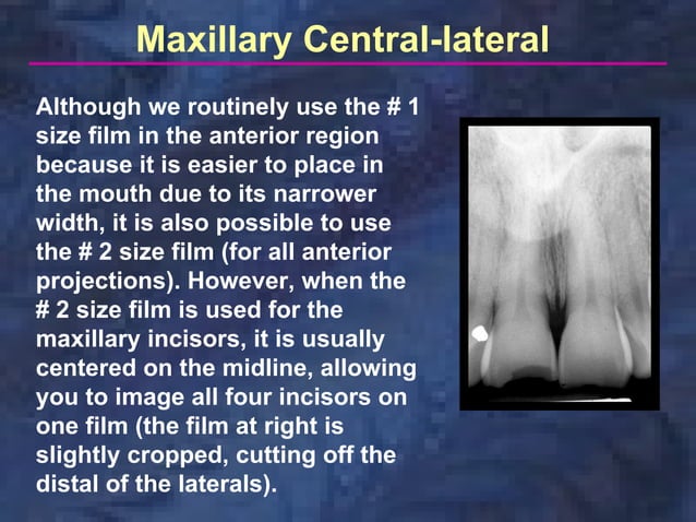 radiology-paralleling-technique | PDF