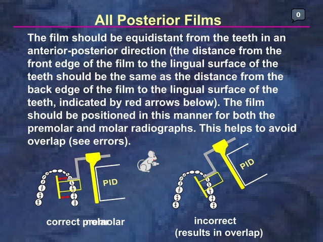 radiology-paralleling-technique | PDF