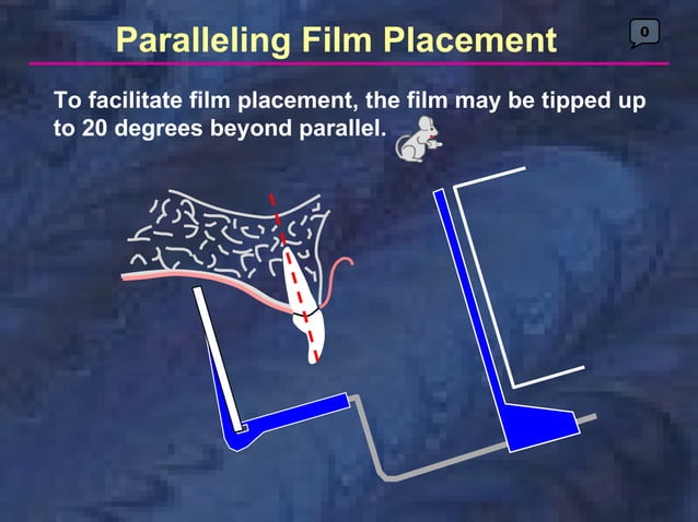 radiology-paralleling-technique | PDF