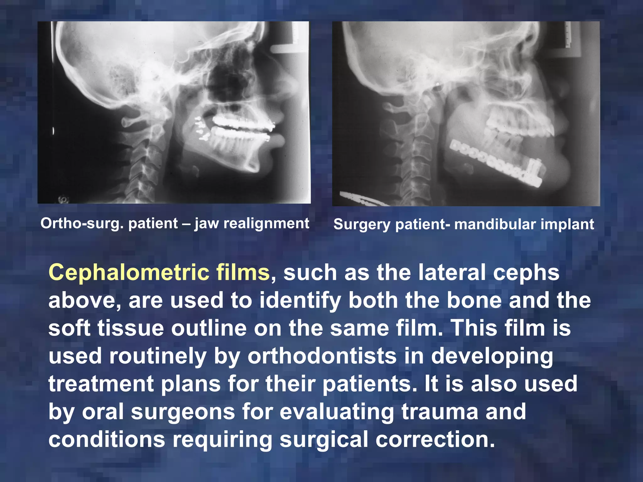 radiology-x-ray film & screens | PDF