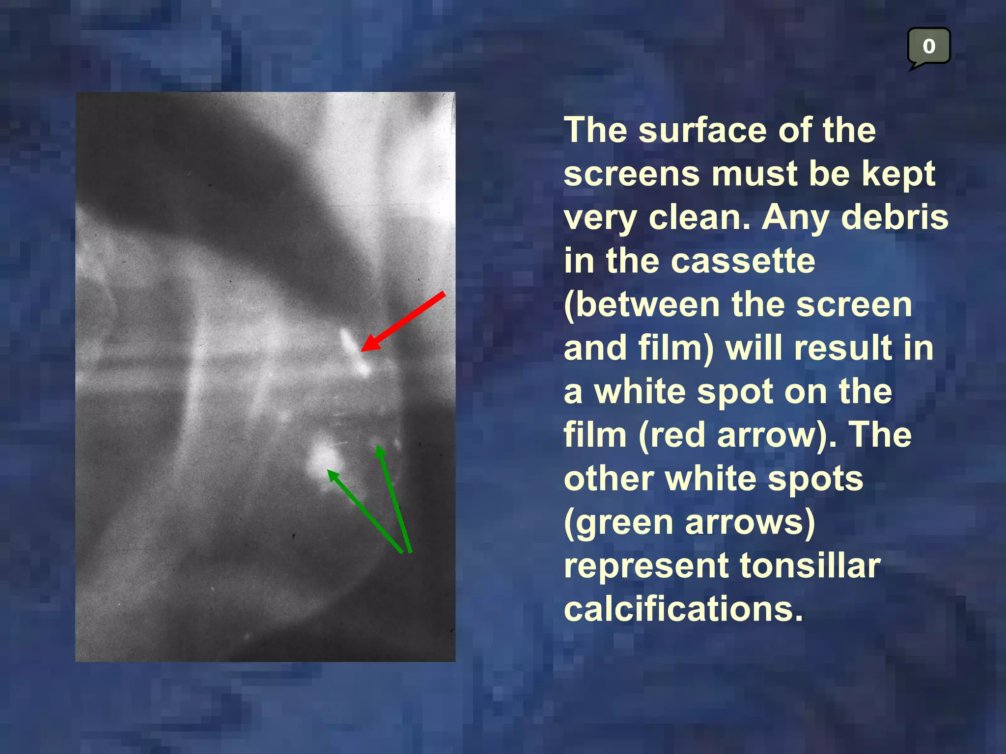 radiology-x-ray film & screens | PDF