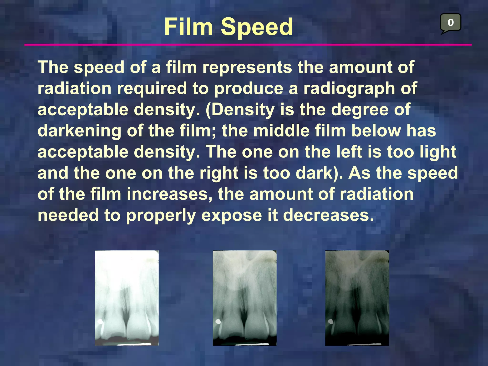 radiology-x-ray film & screens | PDF