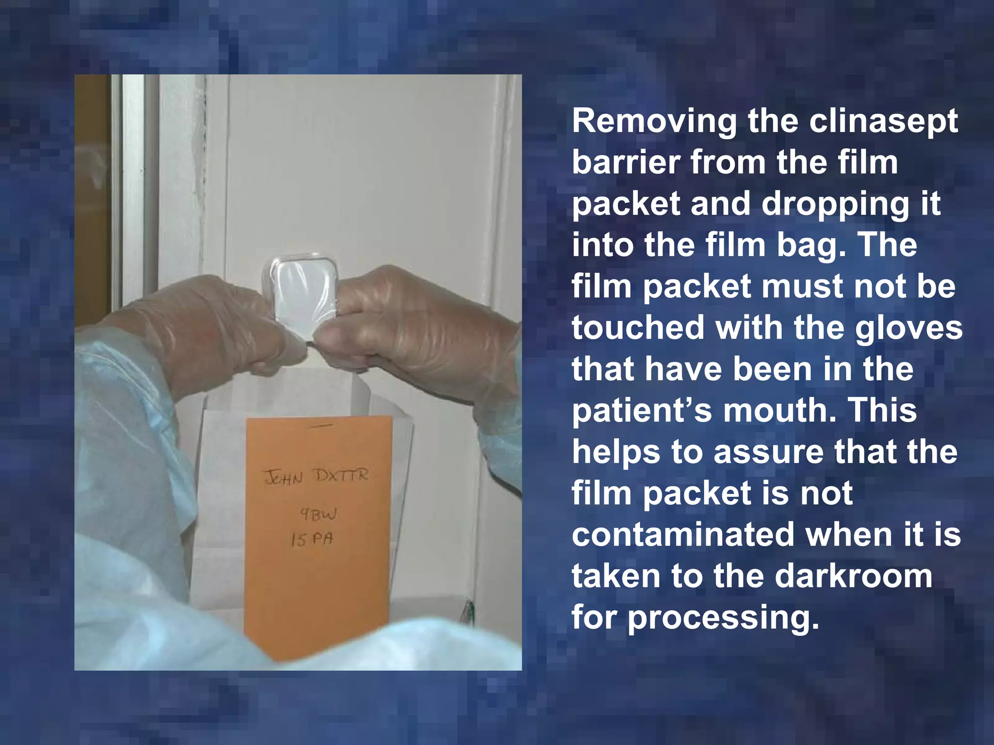 radiology-x-ray film & screens | PDF