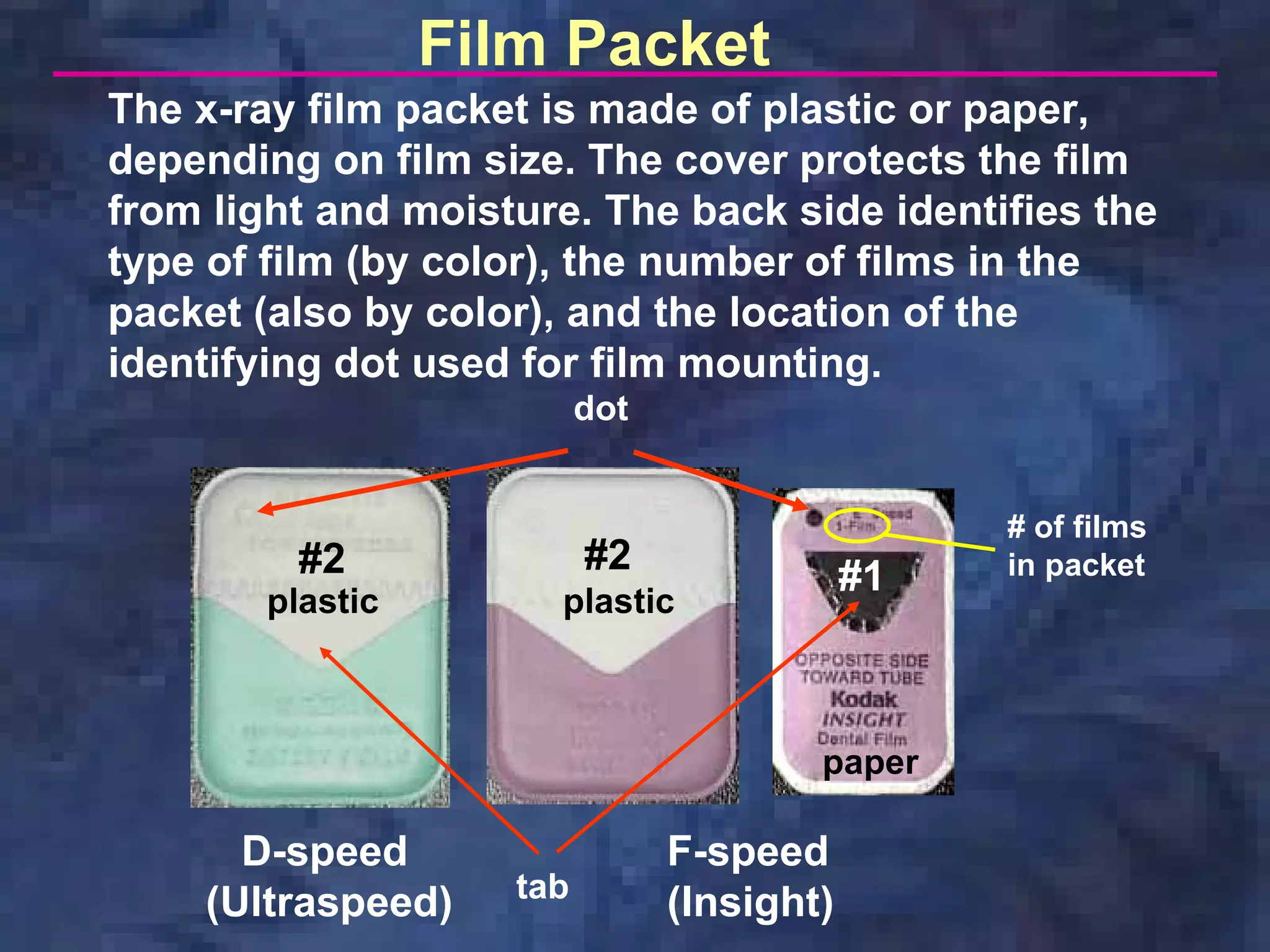 radiology-x-ray film & screens | PDF