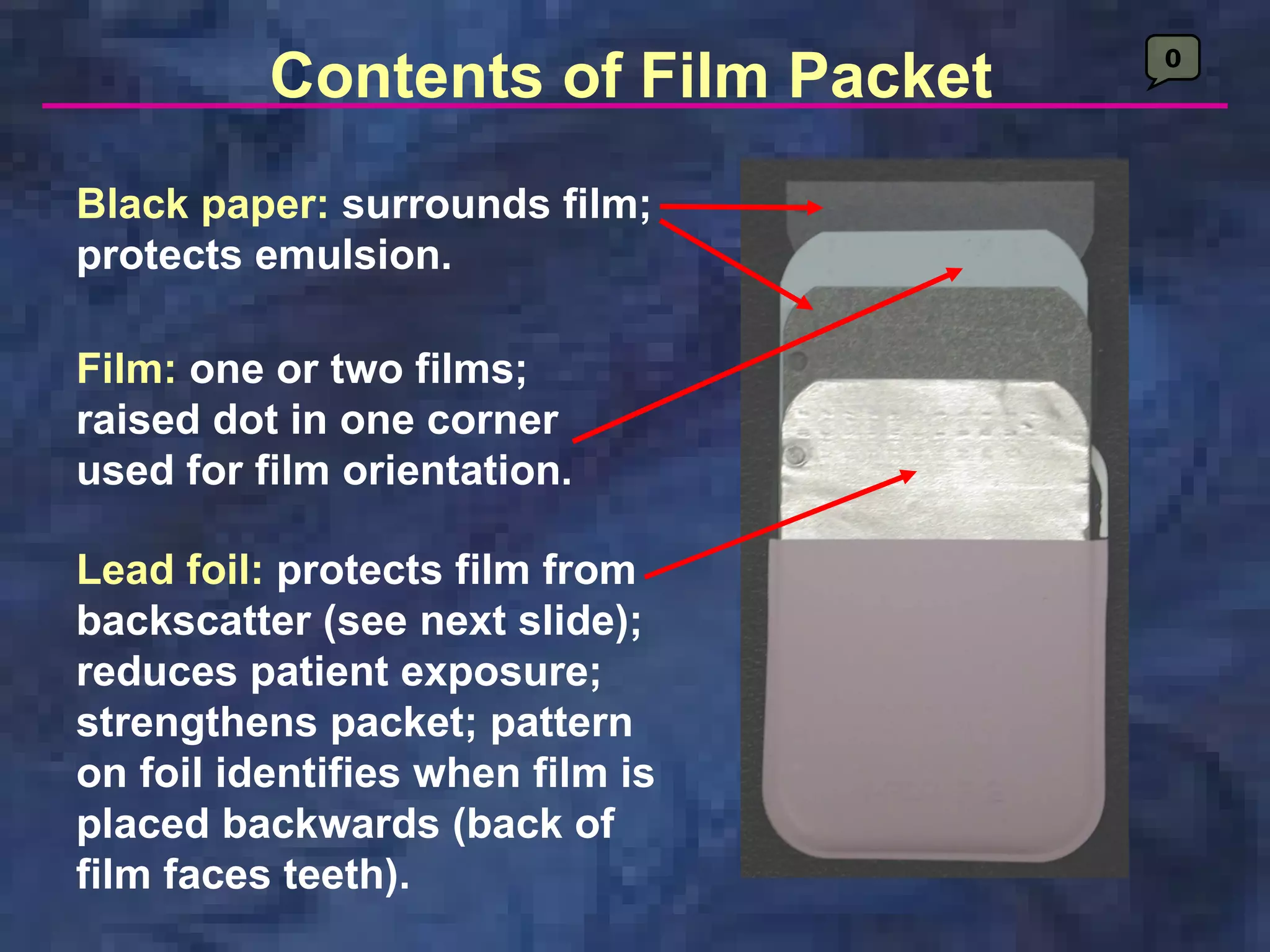 radiology-x-ray film & screens | PDF