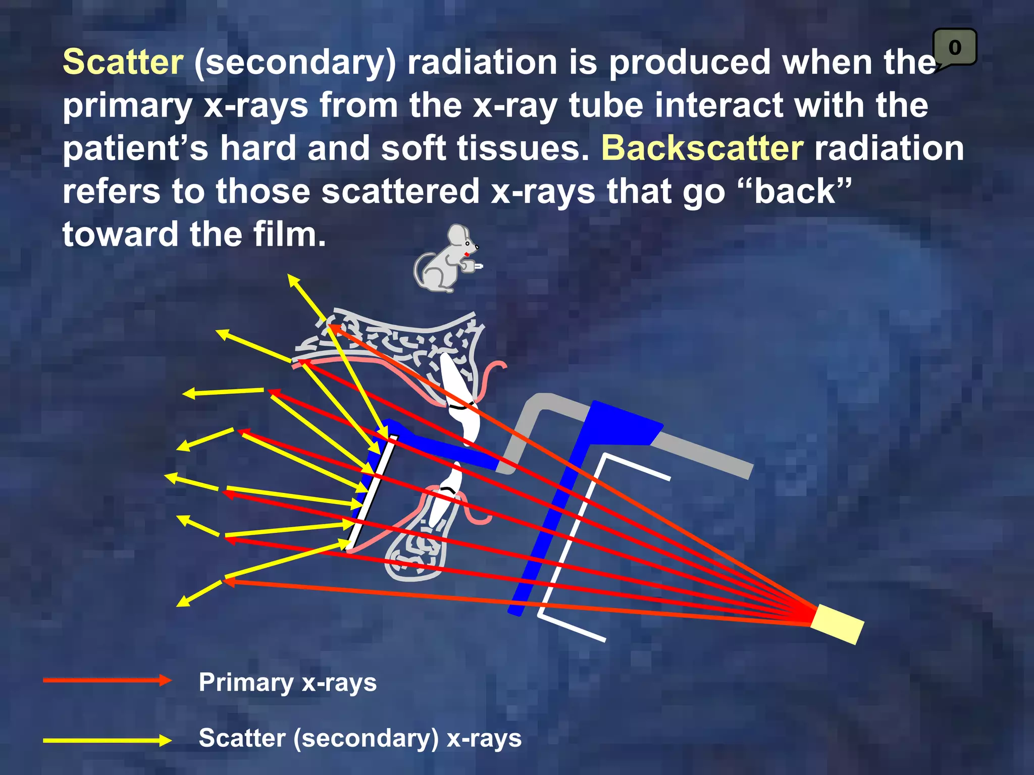 radiology-x-ray film & screens | PDF